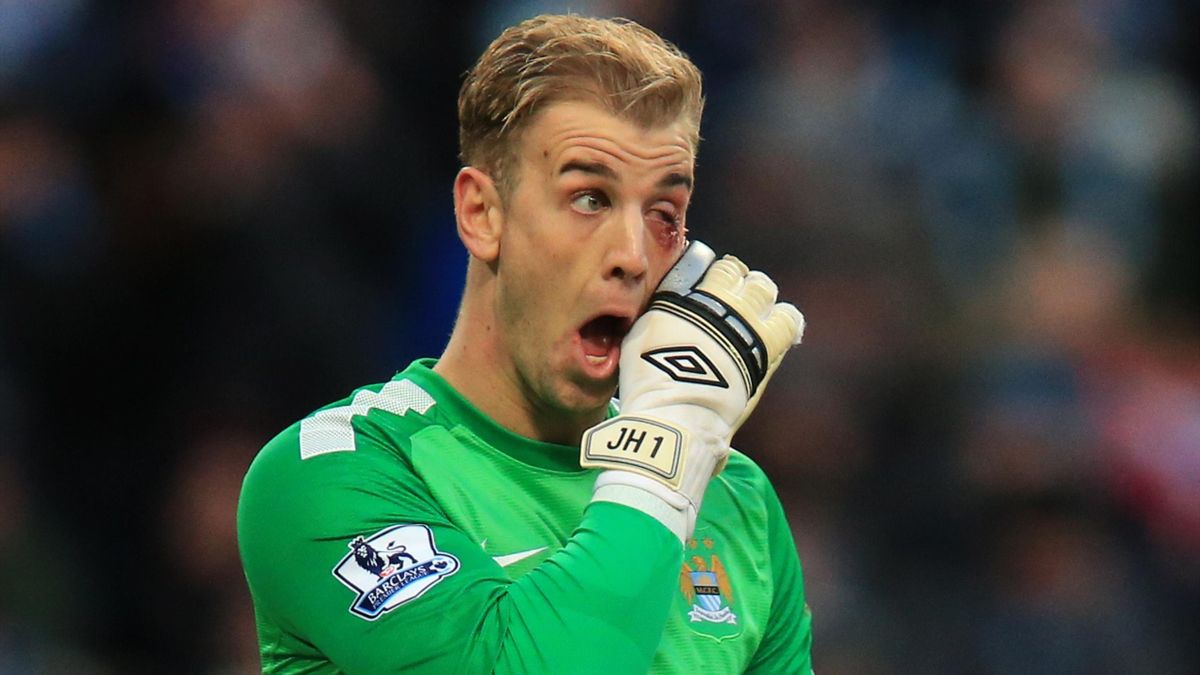 Joe Hart Eye