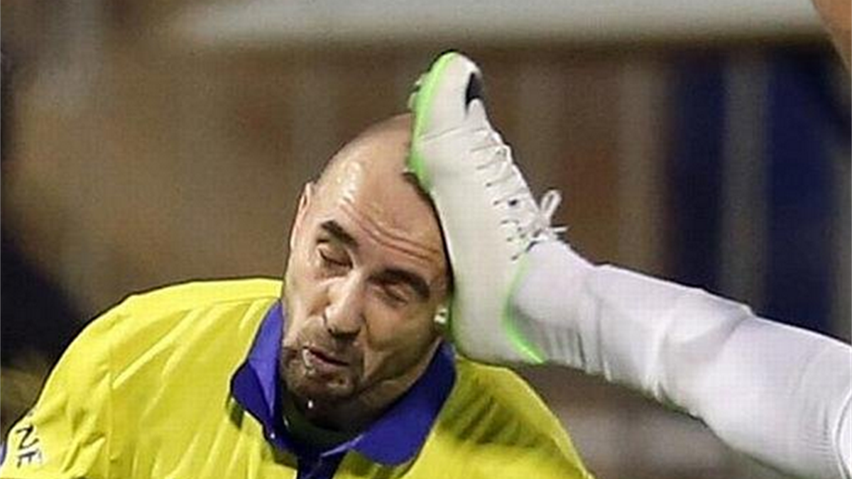 Bu darbe Adrian Mierzejewski’yi hastanelik etti! - Eurosport