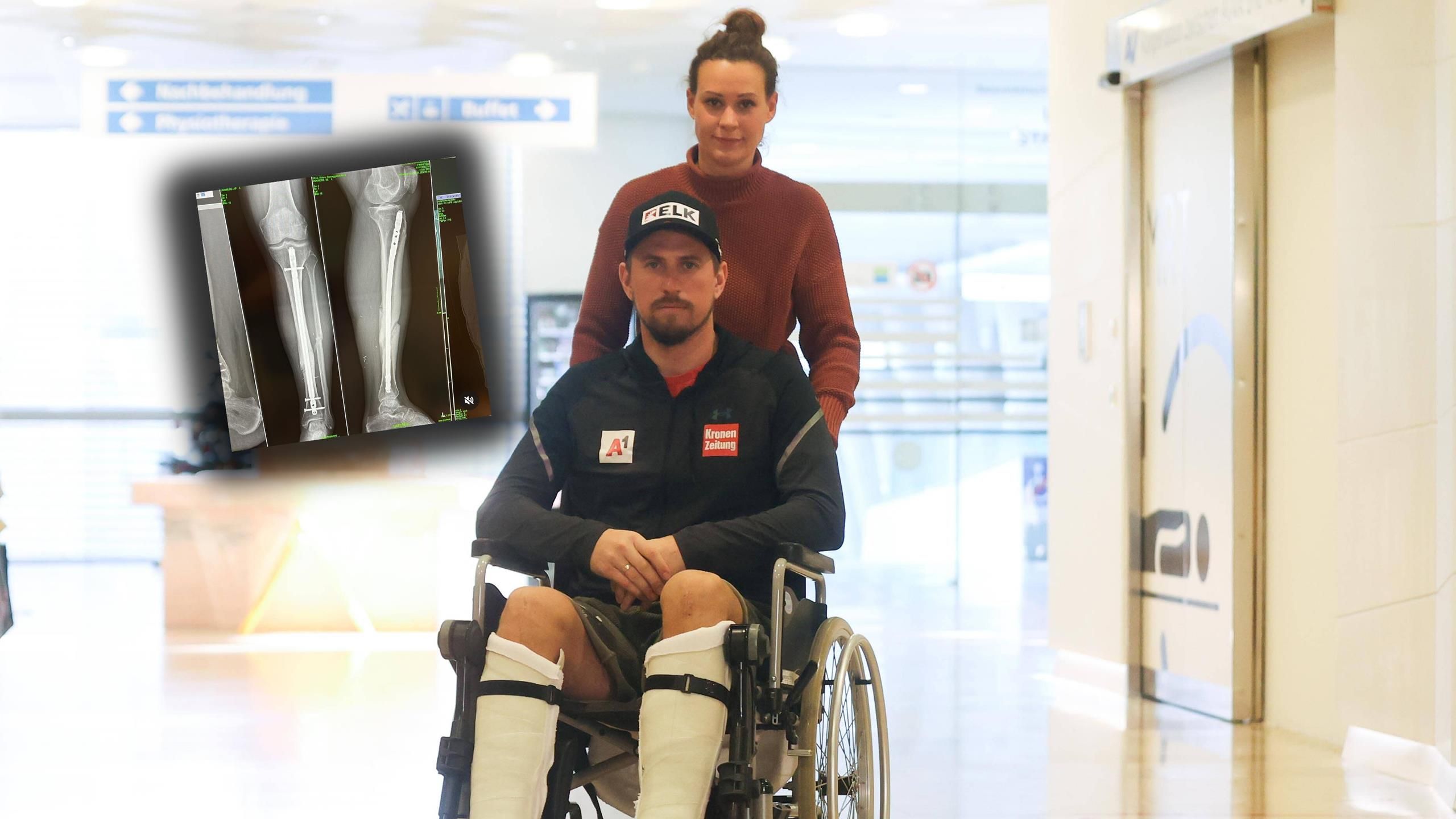Max Franz gibt positives Update nach Sturz im Dezember 2022: "Knochen ...