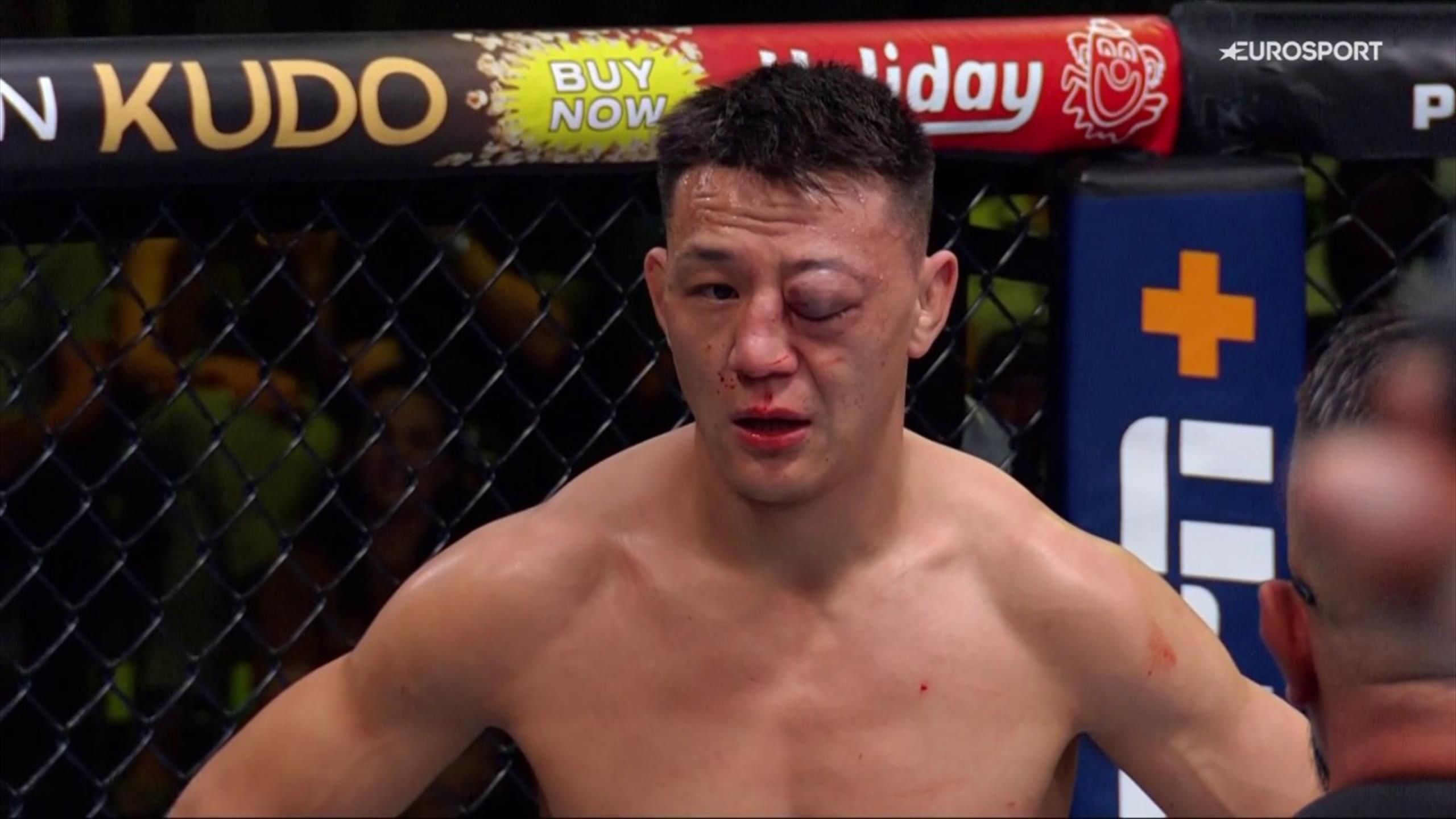 UFC Vegas 97 | Los médicos tuvieron que parar la pelea: Así quedó el ...