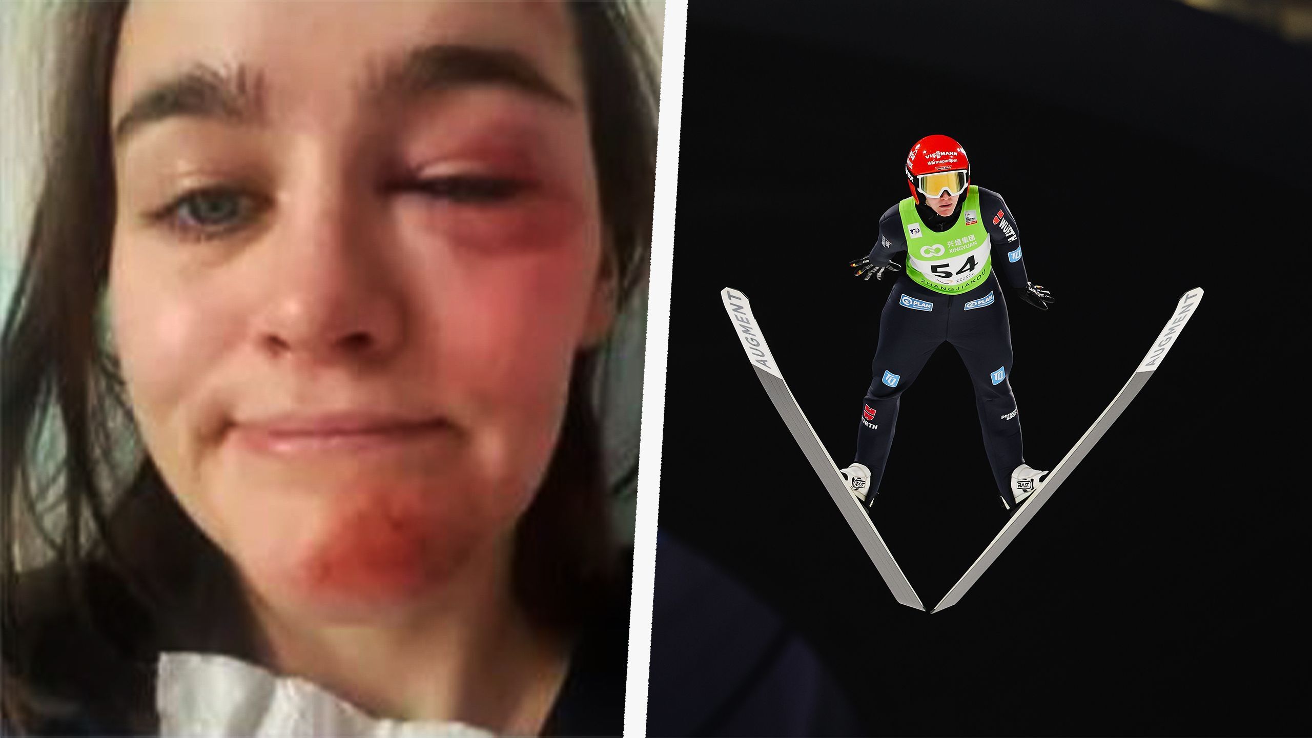 Selina Freitag offenbart Trainingssturz beim Weltcup in China und zeigt ...