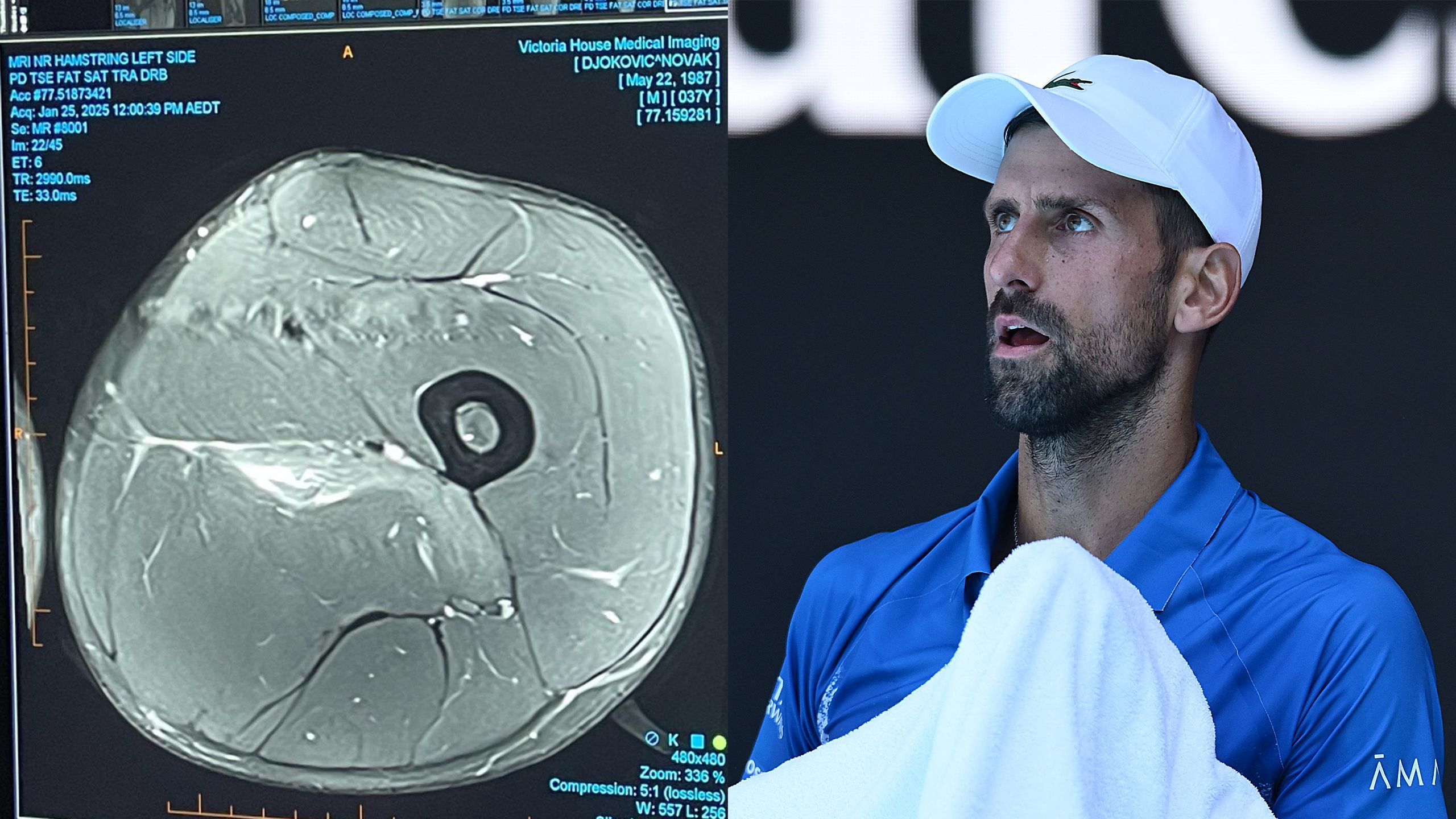 Novak Djokovic mostra le immagini della risonanza magnetica e risponde ...