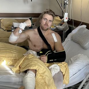 Ski Alpin: Aleksander Kilde postet schockierende Bilder von Riesen ...