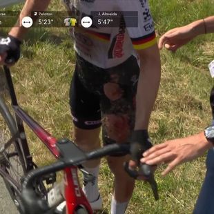 Che botto per Georg Zimmermann! Gli si straccia tutto il pantaloncino ...